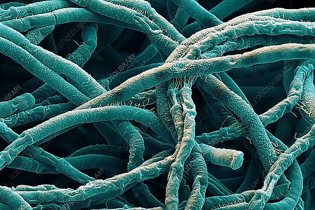 7 more develop symptoms linked to handling meat from anthrax-infected ...